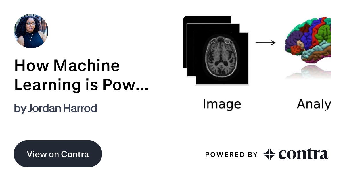 How Machine Learning is Powering Neuroimaging to Improve Brain … by ...