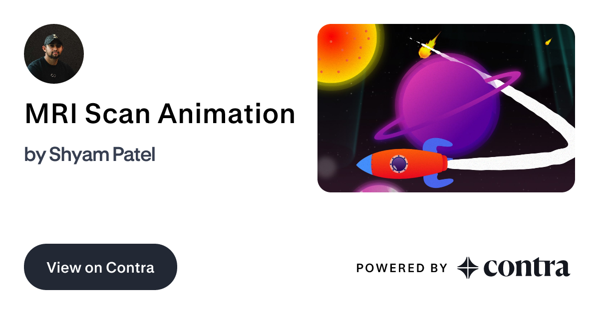 MRI Scan Animation by Shyam Patel